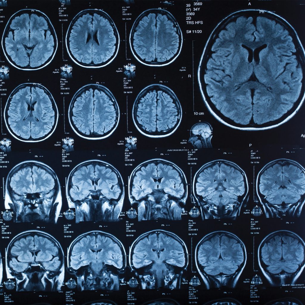 MRI | Eisenhower Imaging Center