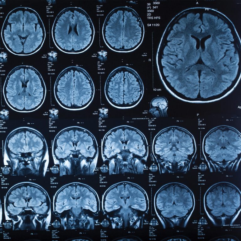 MRI | Eisenhower Imaging Center