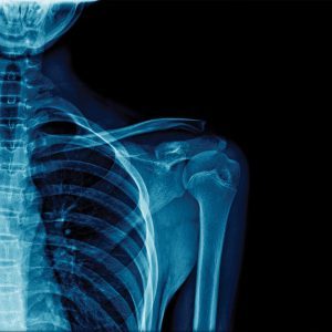 Digital X-Ray | Eisenhower Imaging Center